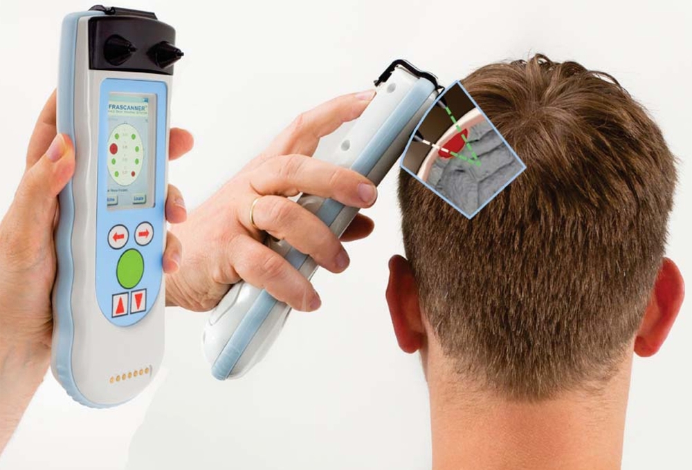 InfraScan Announces FDA Clearance of the First Hand-Held Diagnostic ...